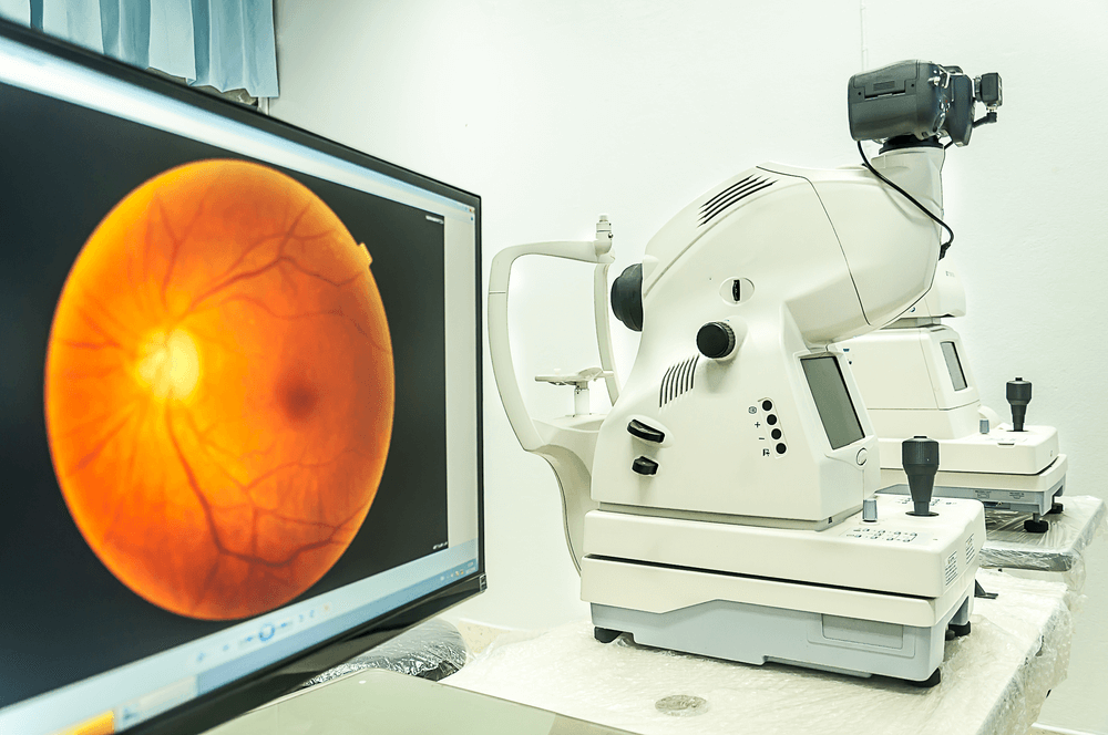 Digital Retinal Photography – C-True Opticians